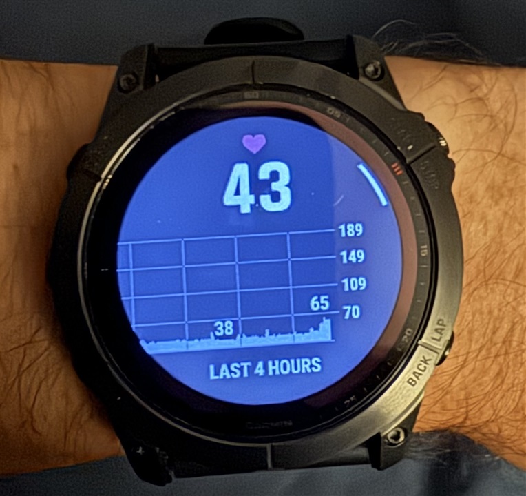 Resting HR from Sleep jumps after Sync - fēnix 7 Series - Wearables ...